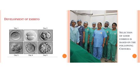 Quality Of Embryo Embryo Grading Page 14