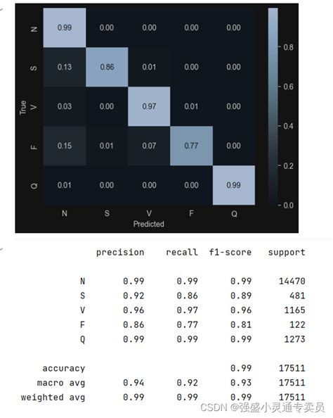 基于卷积神经网络的ecg心电图信号识别准确率98ecg卷积神经网络 Csdn博客
