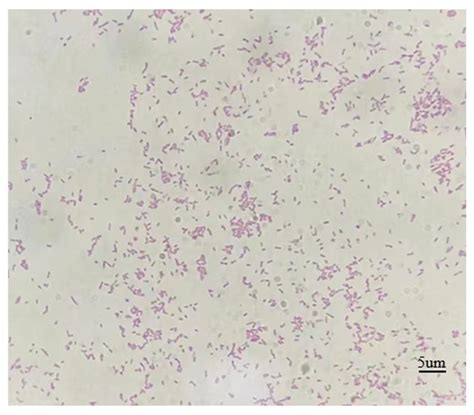 E Coli Gram Stain 100x