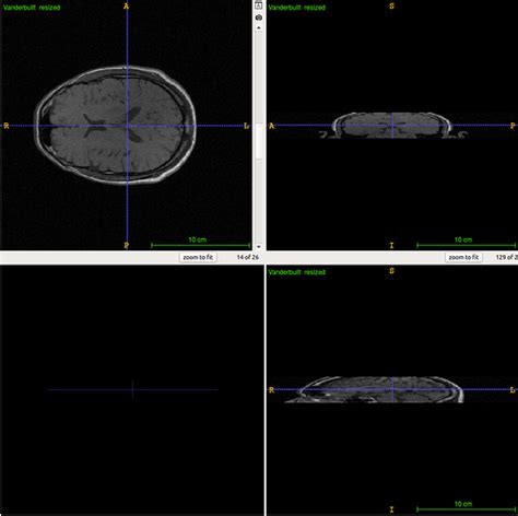 How To Resize A 3d Image Algorithms Itk