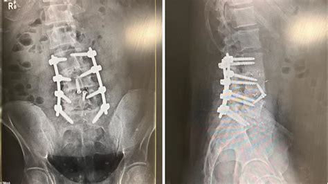 Wayne Perske Reveals The Reason Behind His All Abilities Switch Australian Golf Digest