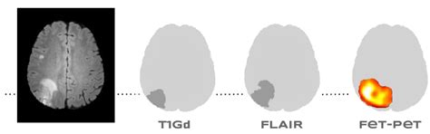 An Illustration Of The Imaging Information Used For Bayesian Model