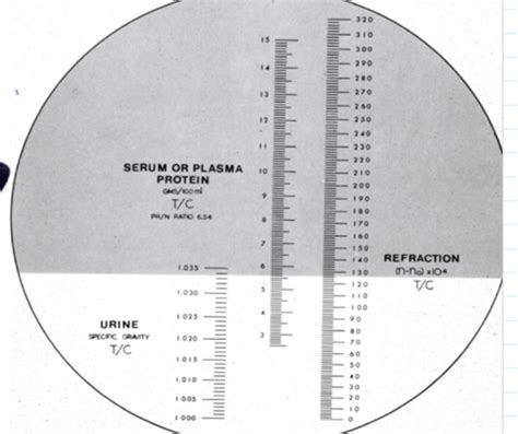 Clin Path L18 Biochemistry Protein Flashcards Quizlet