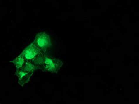 小鼠抗cat单克隆抗体anti Cat Mouse Monoclonal Antibody 生命科学产品与技术服务 生工生物工程上海股份有限公司