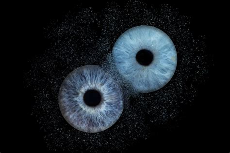 Welcome To Iris Of Mann Iris Of Mann