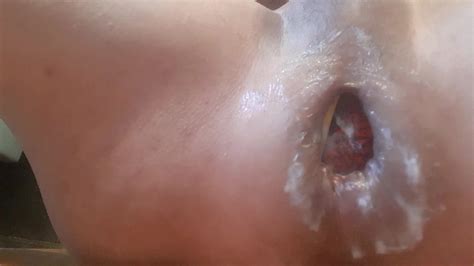 Riesiger Sex Xhamster