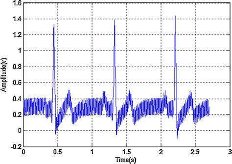 ECG Signal With Power Frequency Interference Download Scientific Diagram