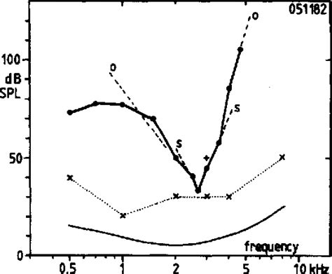 Figure 1 From The Influence Of Cochlear Hearing Loss And Probe Tone