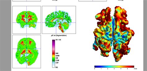 Headreco With An Infant MRI Issue Simnibs Simnibs GitHub