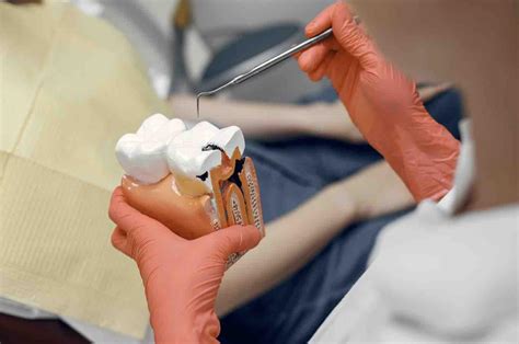 Root Canal Procedure What To Expect And How To Prepare