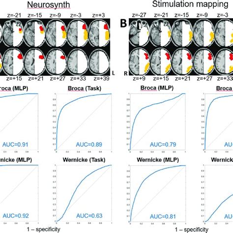 Snr Maps Task Based Functional Mri And Resting State Functional Mri Download Scientific