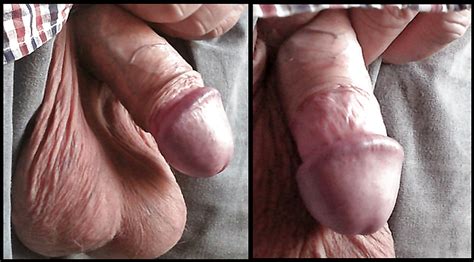 My Penis With Foreskin Remove Porn Pictures Xxx Photos Sex Images