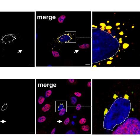 Niv Ibs Prevent Nuclear Translocation Of Stat Proteins After Ifn