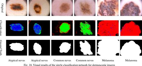 Figure 10 From Multiple Abnormality Detection For Automatic Medical Image Diagnosis Using