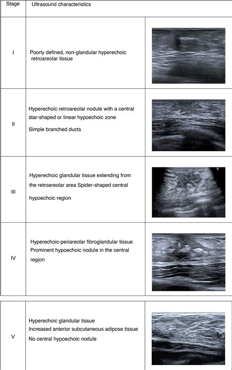 Correlation Between Imaging Findings And Hormonal Markers At The Onset