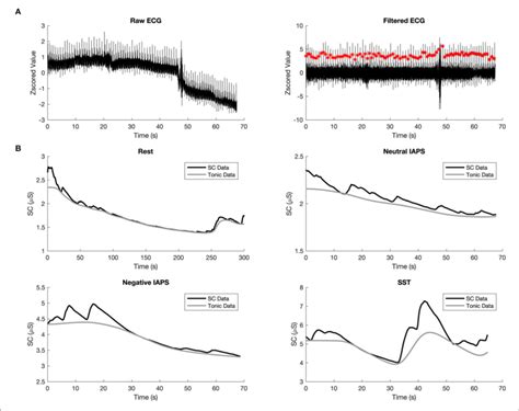Preprocessing Of Ecg And Gsr A Example Waveform Of Raw Ecg Left