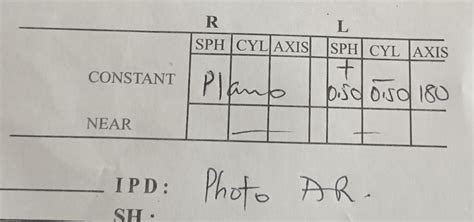 Disoriented Vision When I Wear My New Glasses But It Becomes Normal