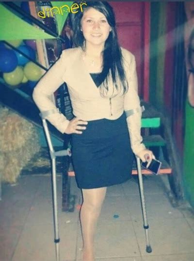 Cf Amputees Tumblr Com Tumbex Cf Amputees Tumblr Com Tumbex