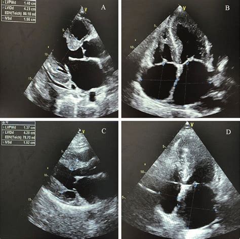 Cardiac Imaging This Example Showed The Morphological Similarities