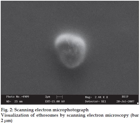 Preparation And Characterization Of Ethosomes For Topical Delivery Of Aceclofenac