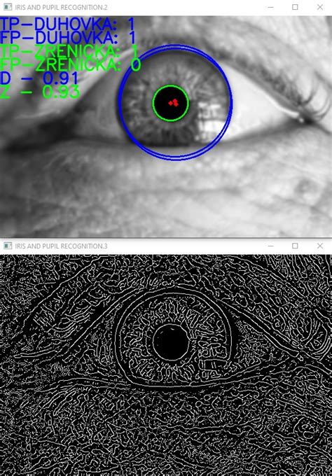 GitHub Xdurfina Iris And Pupil Image Recognition With Ui In This Repository You Can Try And