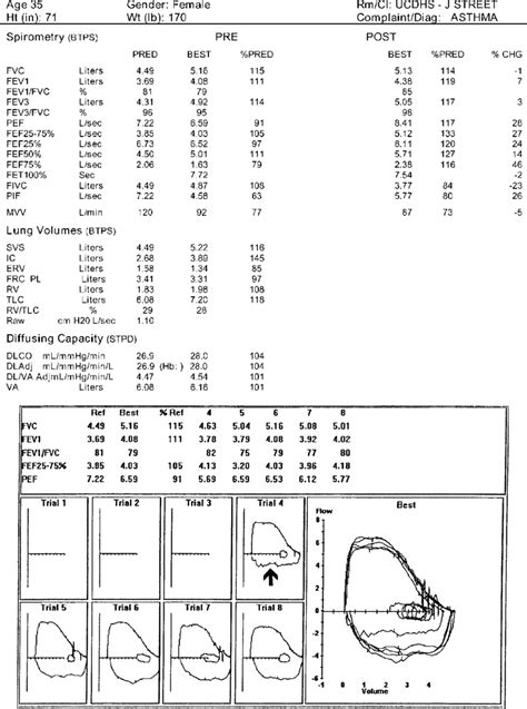 Pulmonary Function Tests And Flow Volume Loop From A Patient With A Download Scientific Diagram