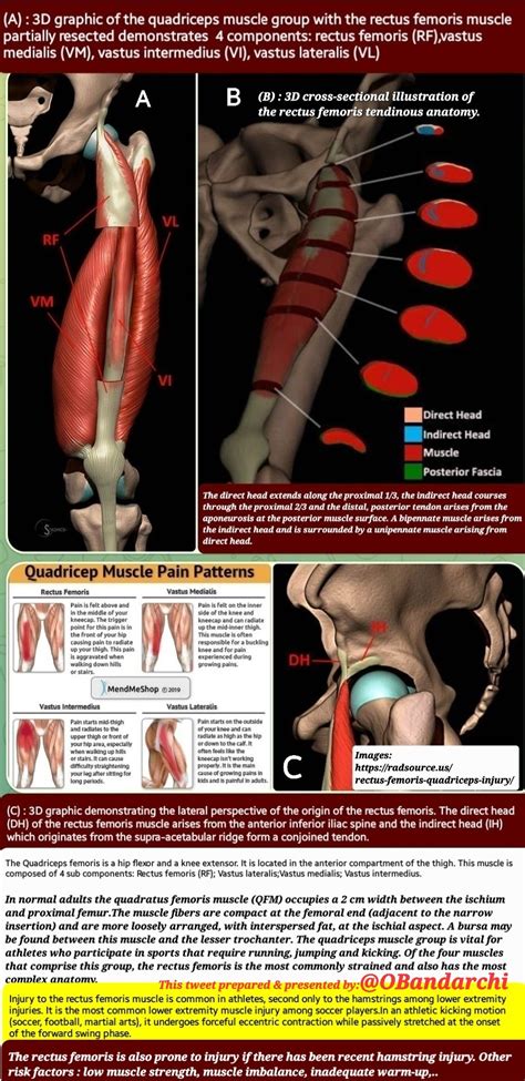 Quadriceps Femoris Muscle Group Blog Fitness Physio Newcastle