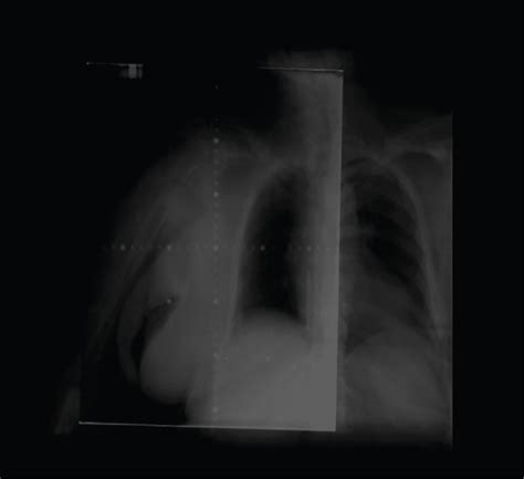 Ensuring Agility And Safety In The Verification Of Radiotherapy Portals The Importance Of Using