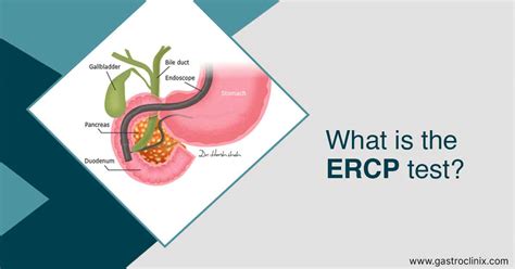 Ercp Dr Harsh J Shah Ercp Dr Harsh J Shah
