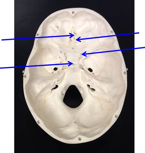Biol 213 Skull 5 Diagram Quizlet