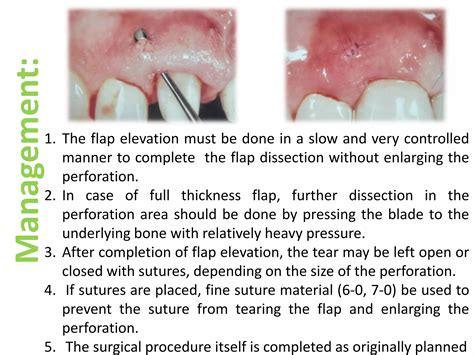 Post Operative Complications Of Periodontal Surgery Pdf