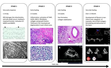 Figure 1 From Assessment Of Myocardial Diastolic Dysfunction As A