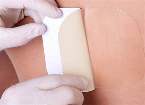 بهترین چسب برای زخم بستر کدام است معرفی بهترین چسب زخم بستر