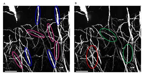 Dendritic Spine Quantification Using An Automatic Three Dimensional