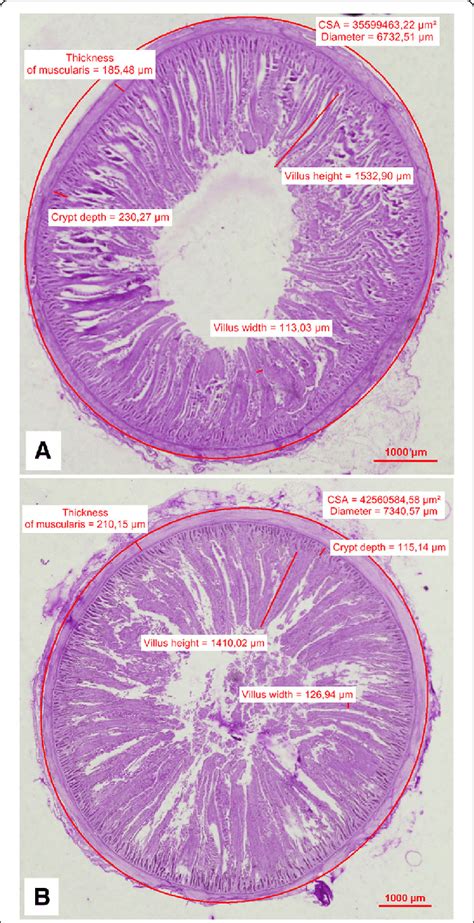 A Photomicrograph Light Microscope Of The Duodenum Csa Diameter Download Scientific