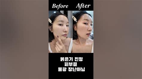 리브이셀 가정용 리프팅 기기 사용리뷰리브이셀가정용리프팅기기피부탄력피부재생화이트닝물광피부 Youtube
