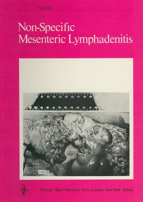 Non Specific Mesenteric Lymphadenitis Books Gateway Karger Publishers
