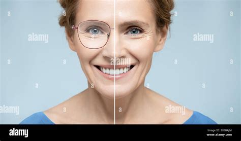 Laser Vision Correction Woman Face With And Without Glasses On Blue