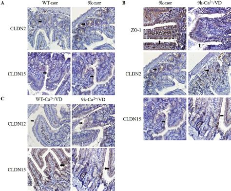 Localization Of Tight Junction Proteins In The Duodenum Differential