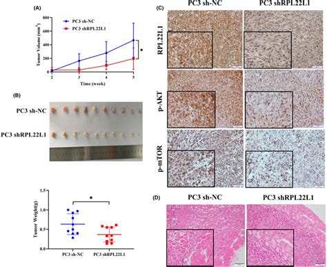 Rpl22l1 Promotes Pca Cell Growth And Invasion In Vivo The Sh‐nc And