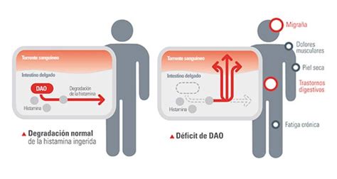 Déficit de DAO