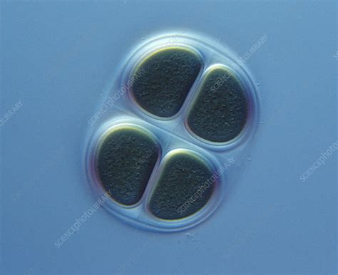 Chroococcus Turgidus Cyanobacteria Stock Image C005 8238 Science Photo Library