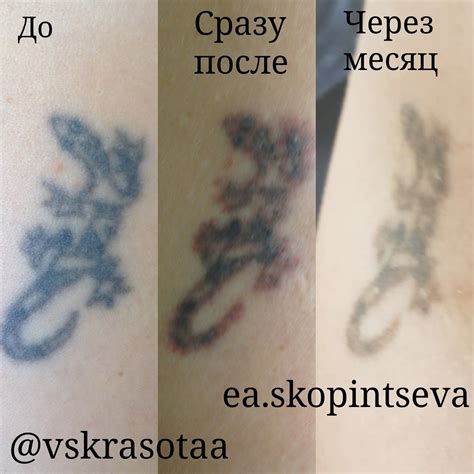 Татуировка заживление (77 фото)