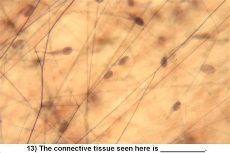 Quiz Connective Tissues Histology Atlas For Anatomy And Physiology