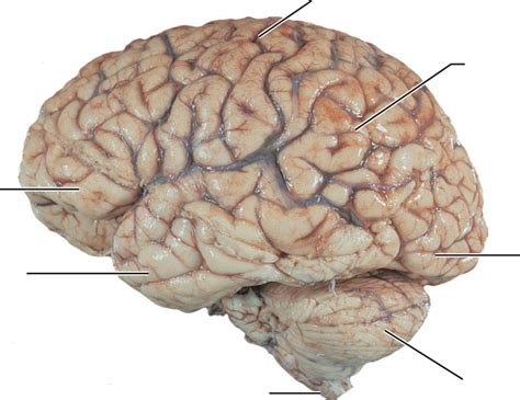 Cns Structures Part 3 Diagram Quizlet