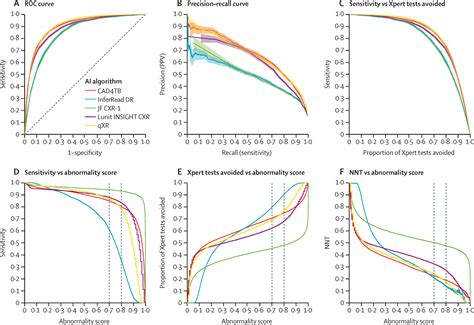 Tuberculosis Detection From Chest X Rays For Triaging In A High Tuberculosis Burden Setting An