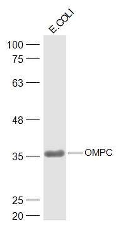 Ompc Polyclonal Antibody Bs 20213r