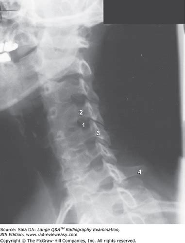 Trunk Projections Spine Flashcards Quizlet