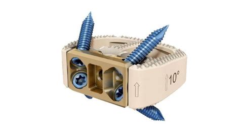 Synfix® Evolution Alif Implant Depuy Synthes