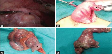 Journal Of Minimal Access Surgery